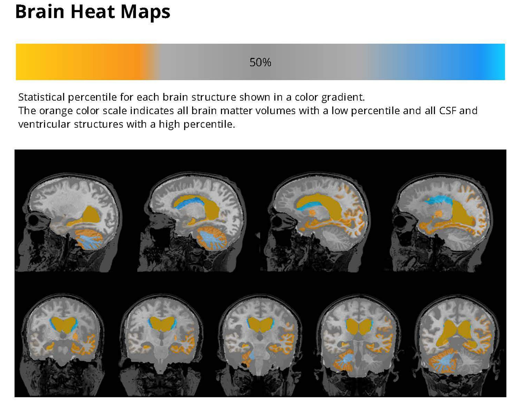 Early Detection of Neurodegenerative Disease with Neuroreader®